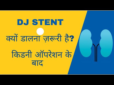 DJ STENT क्यों डालते है? KIDNEY STONE OPERATION के बाद ।Dr Santosh Agrawal