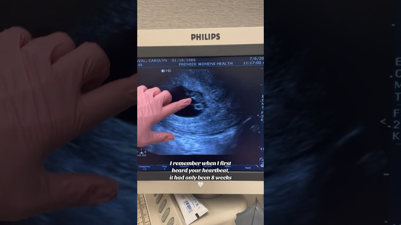 See you next month, little one 🥹 #ultrasound #8weeks #pregnant #pregnancy #pregnancyjourney