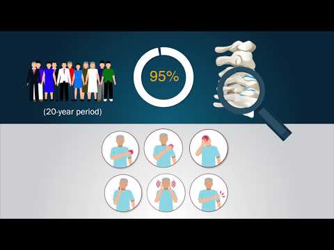 A 20-Year Prospective Longitudinal Study of Degeneration of the Cervical Spine...