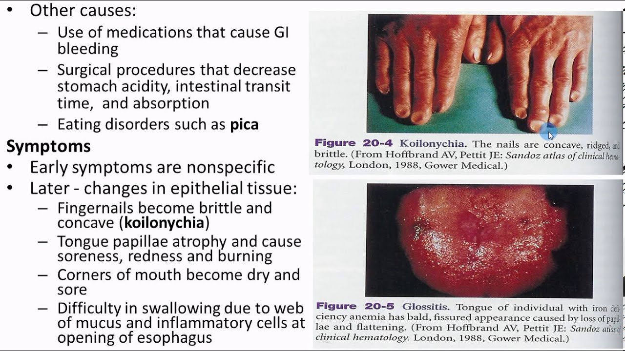 PATHOPHYSIOLOGY essentials EXPLAINED cardiovascular 4b of 5 anemias