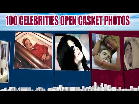GRAPHIC! The Most DISTURBING Celebrity Open Casket Photos EVER Taken (VIEWER DISCRETION ADVISED)
