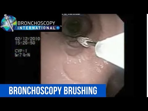 Flexible Bronchoscopy Basic Techniques 5 - Brushing