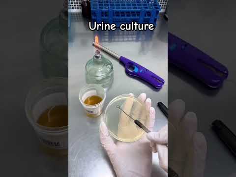 #pathology #doctor #microbiology #urine #culture #viralvideo #post #reels #medicalstudent #students