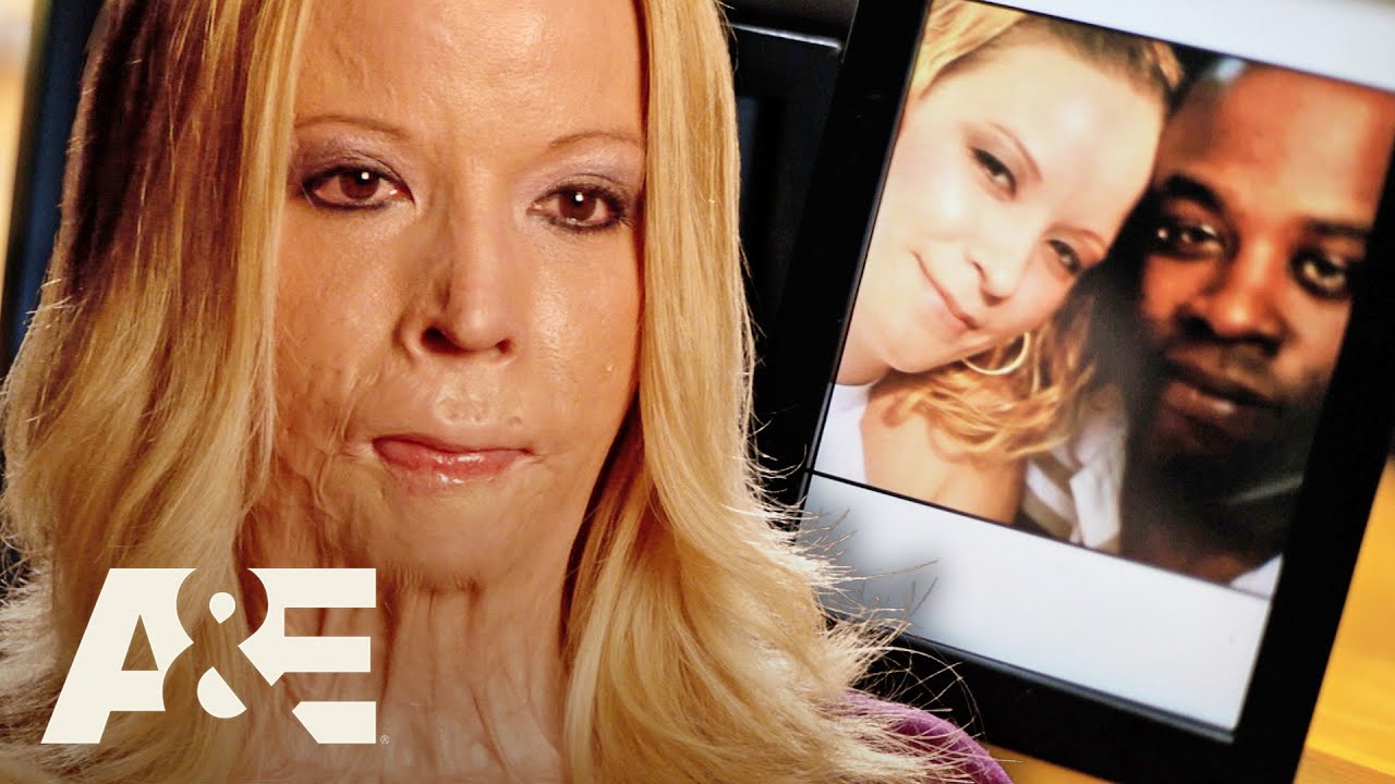 Lying Ex Burns Audrey ALIVE With Gasoline | I Survived... | A&E