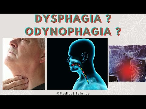 What is Dysphagia? types, causes, diagnosis and treatment