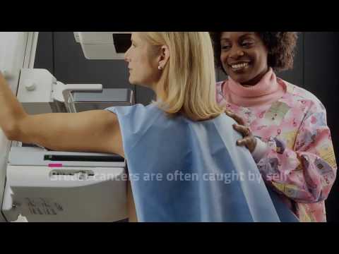 Inflammatory Breast Cancer (IBC) PSA