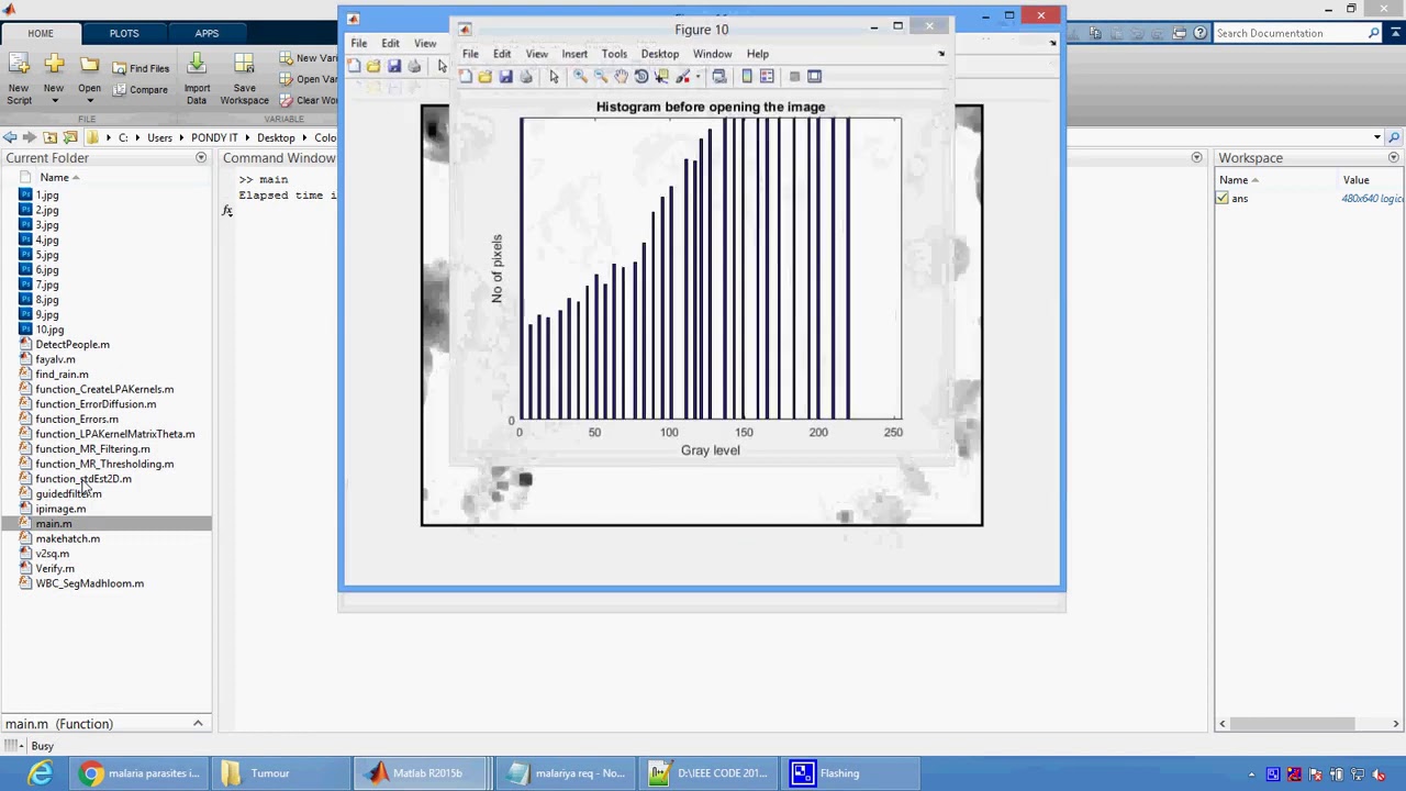 Colour Image Segmentation For Malaria Parasites Detection Using Cascading Method In Matlab