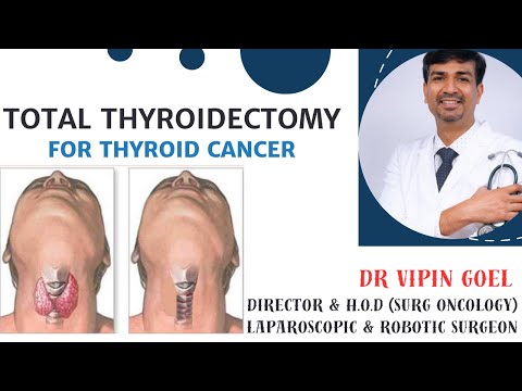 Total Thyroidectomy (11 Steps to Avoid Complications) • Video • MEDtube.net