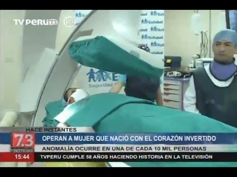 EsSalud implantó marcapaso a mujer que nació con corazón invertido | TVPerú