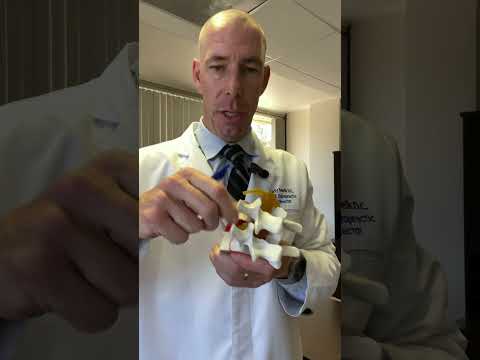 What is Foraminal Stenosis?