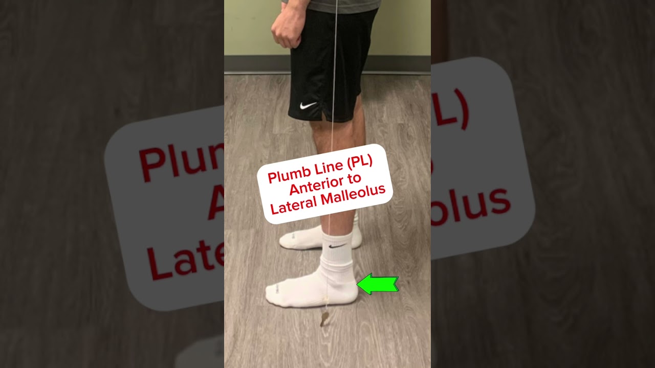 Postural Assessment: Lateral View
