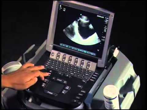 How To: Ultrasound FAST Exam - Male Pelvis