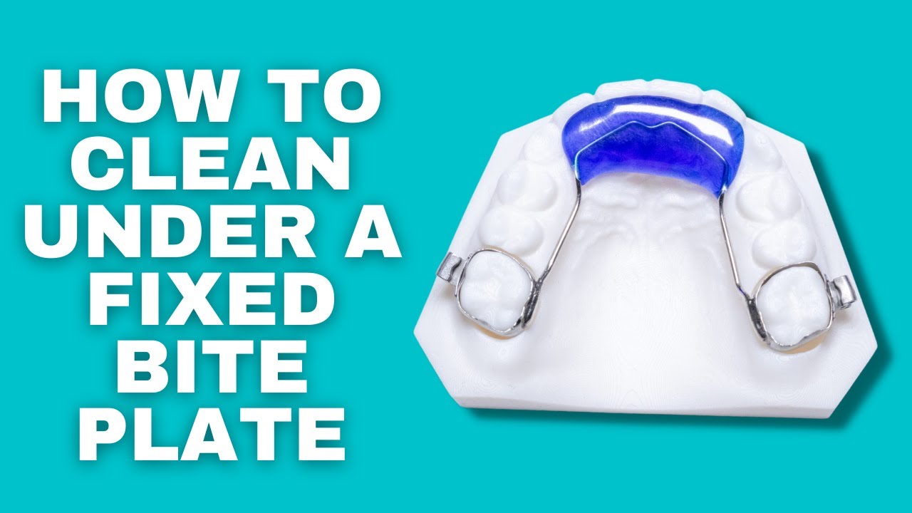 How to Clean Under a Fixed Bite Plate or Any Fixed Appliance