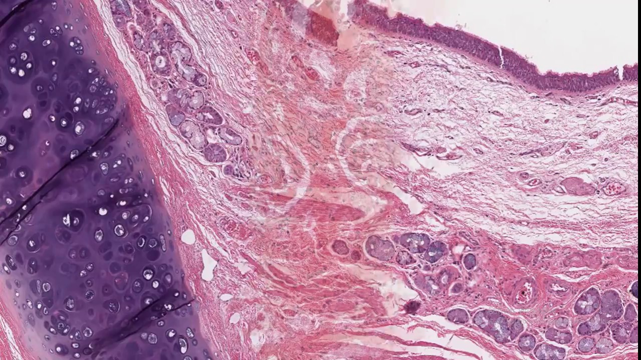 Histología de la Tráquea