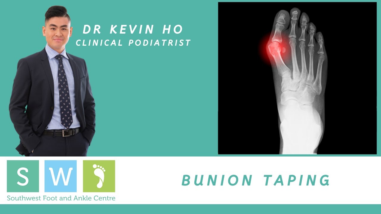 Bunion Taping