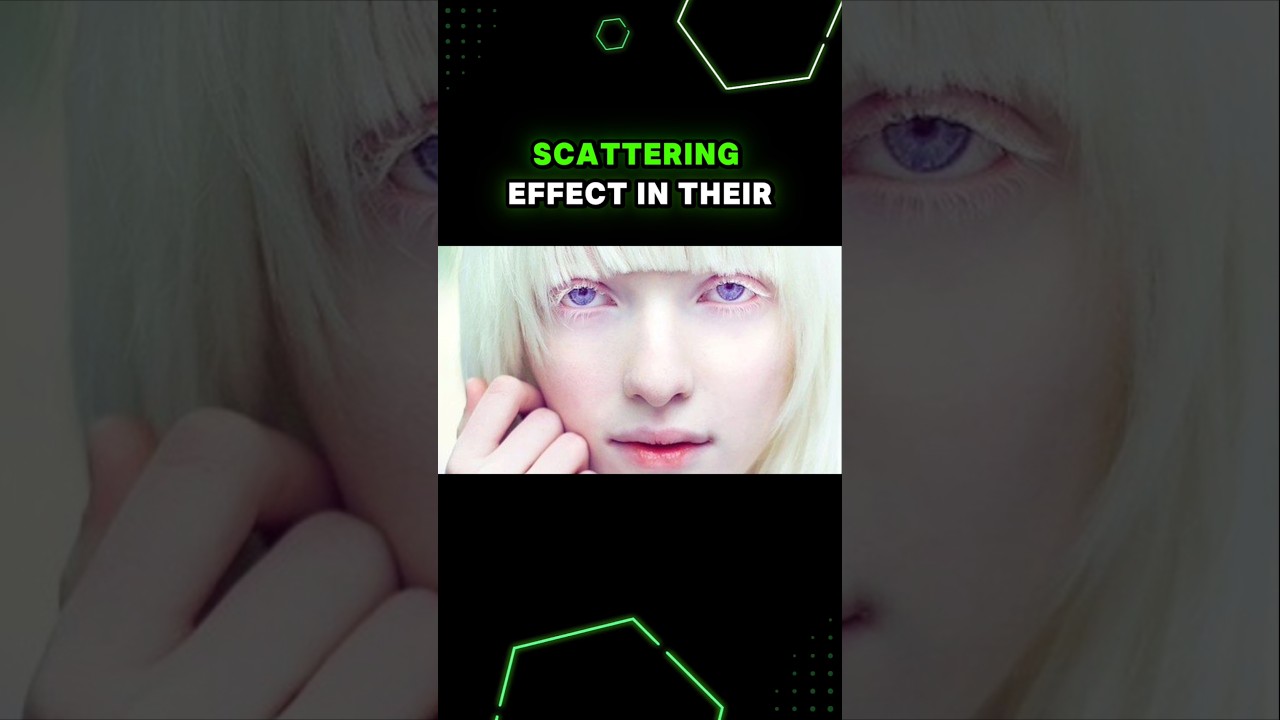 Red and Violet Eyes from Albinism!
