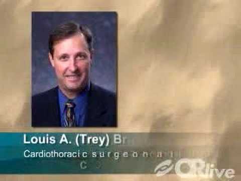 CARDICA C-PORT ANASTOMOSIS SYSTEMS For Beating Heart Surgery