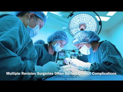 Transvaginal Mesh Lawsuits and Settlements