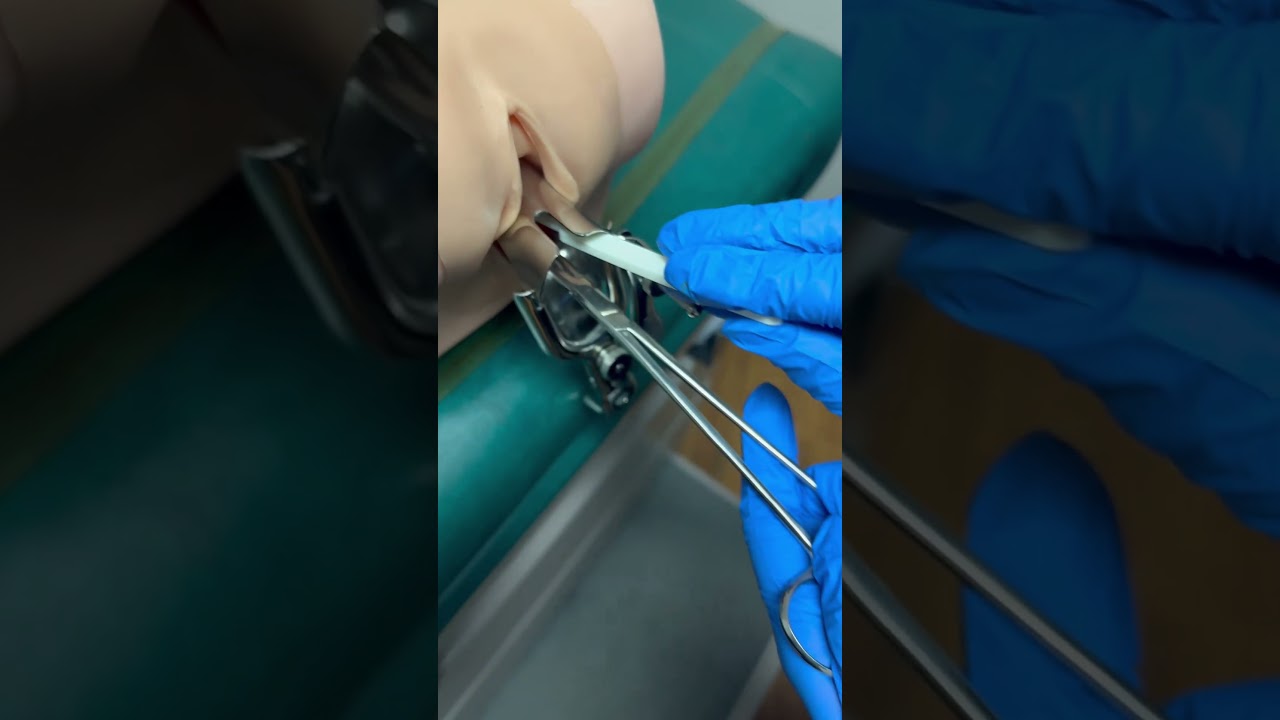 Measuring “sounding” for an IUD