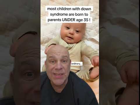 most children with down syndrome are born to parents UNDER age 35!