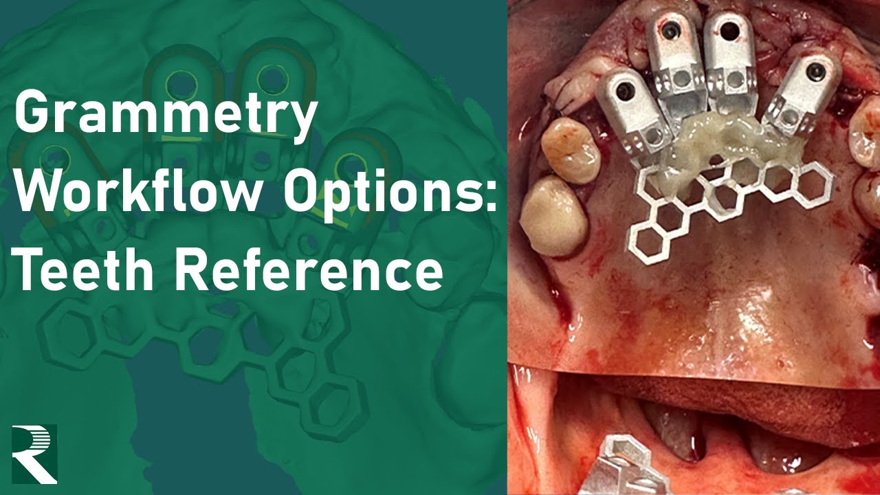 Grammetry Workflow Options: Tooth Reference