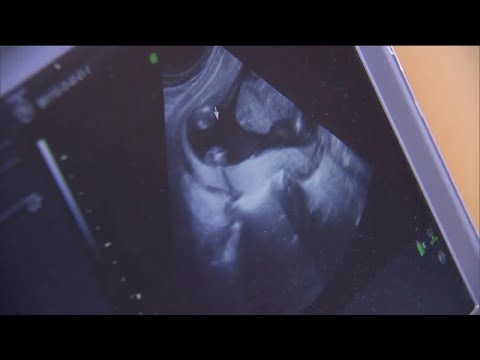 Benton, Washington could soon be 'pro-life' counties