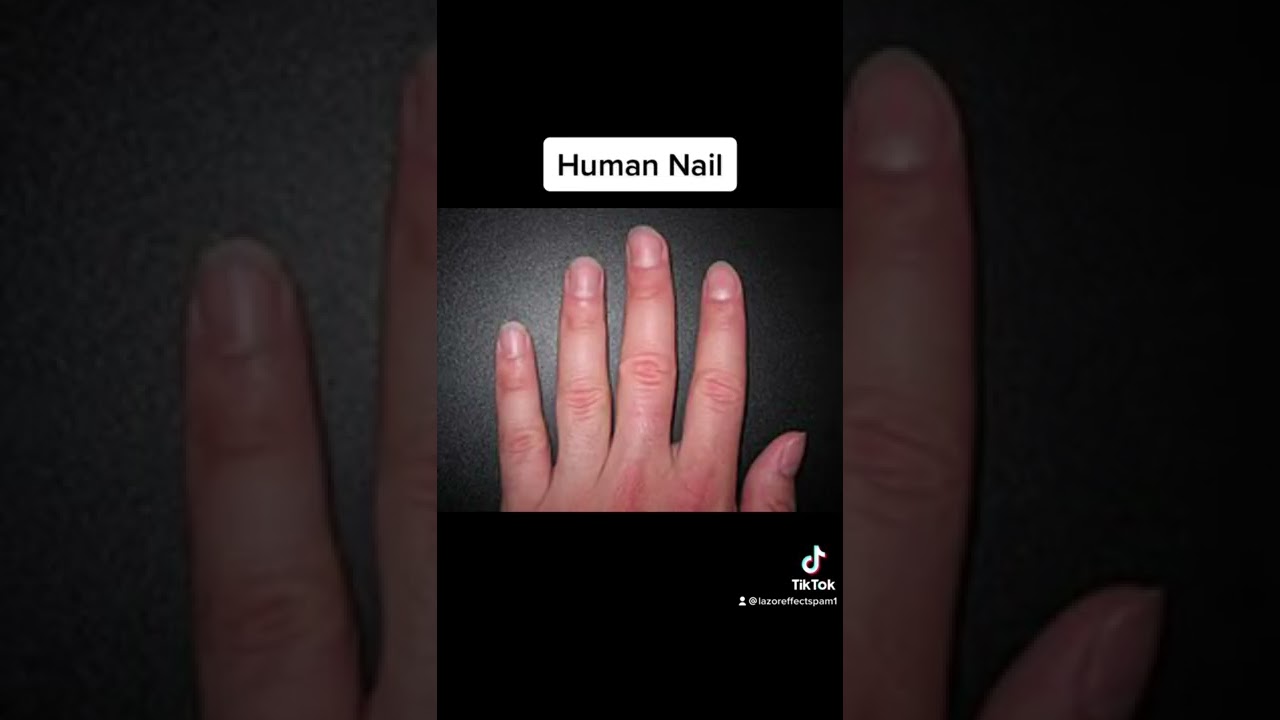 Things That Look Scary When Zoomed In #shorts