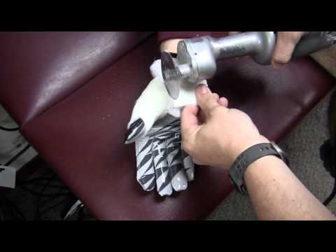 Functional Thumb Spica Cast