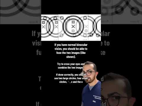 This Binocular Vision Test checks for your ability to cross your eyes and fuse the seperate images s