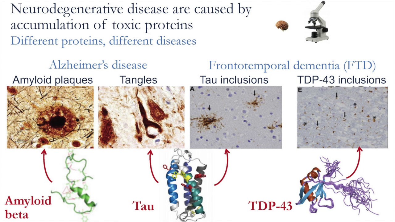 “Introduction to Neurology” by Howard Rosen, MD, at the MAC Research Education Event