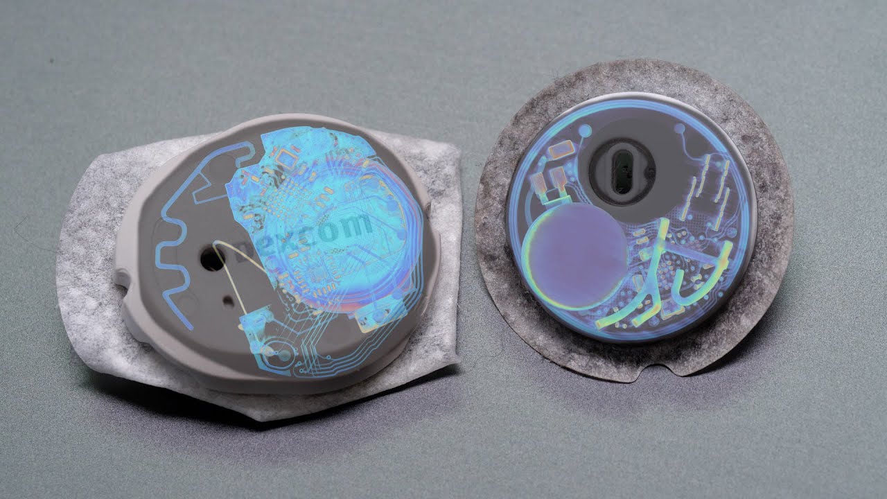 What's Inside Continuous Glucose Monitors?