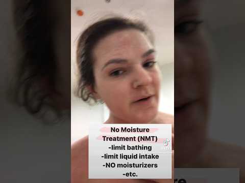 My Video on NMT and MW during TSW #topicalsteroidwithdrawal #tsw