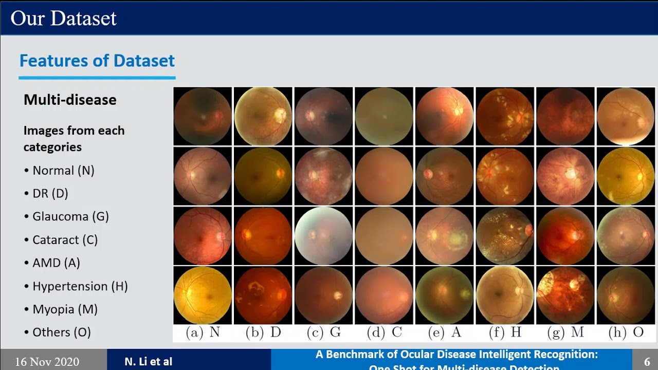 A Benchmark of Ocular Disease Intelligent Recognition: One Shot for Multi-disease Detection