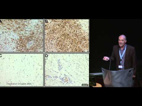 Dr. David O'Gorman 'The extracellular matrix" 2015 Dupuytren Symposium