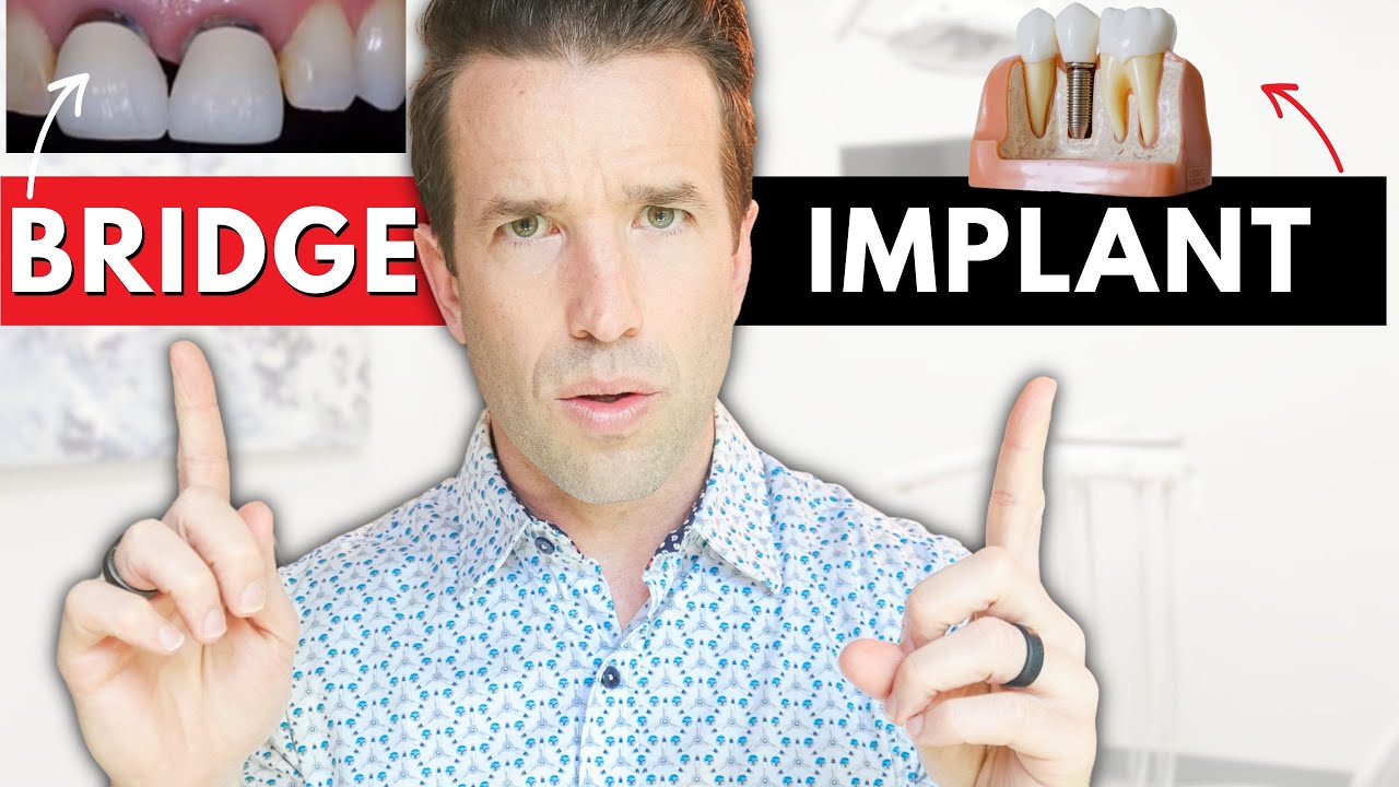 Consequences of Missing Teeth | Difference Between Bridge and Implant