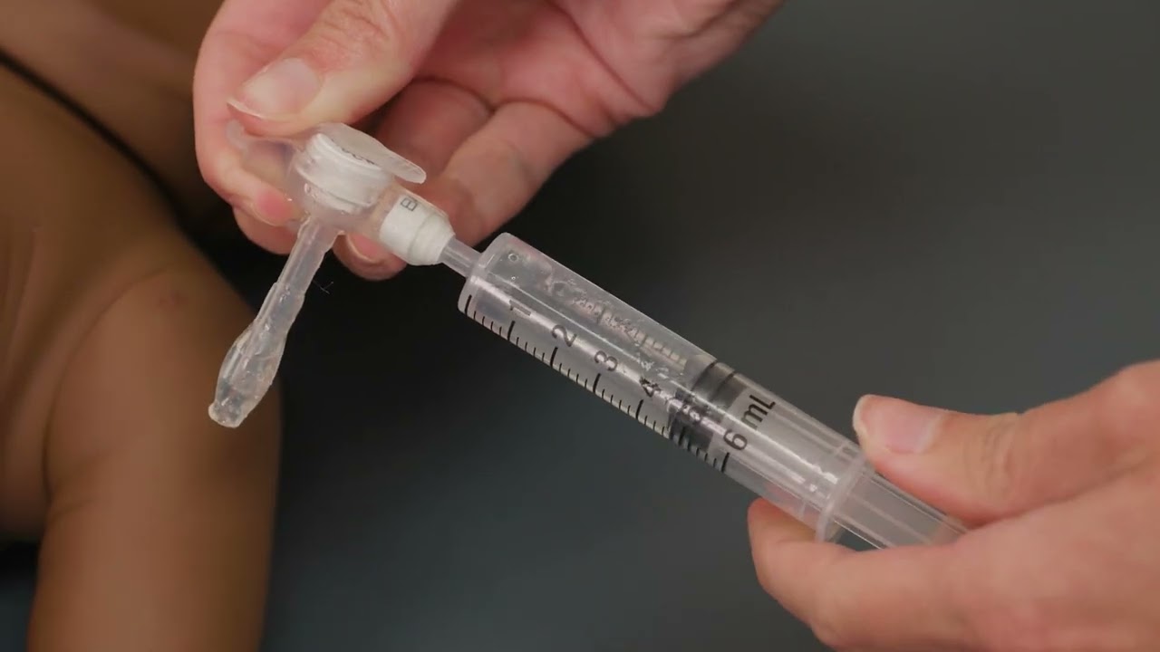 Gastrostomy Tube Care After Initial Placement