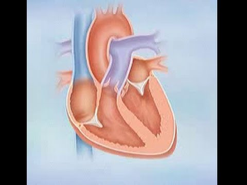 Systolic Heart Failure