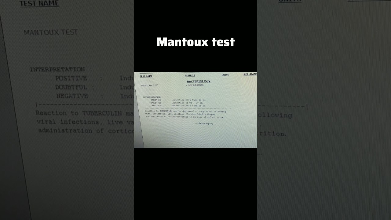 Mantoux test | Mantoux test report| Tuberculin Skin test | TB test | TB Skin test #tbtest