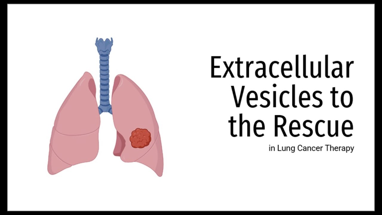 Extracellular Vessicles to the Rescue