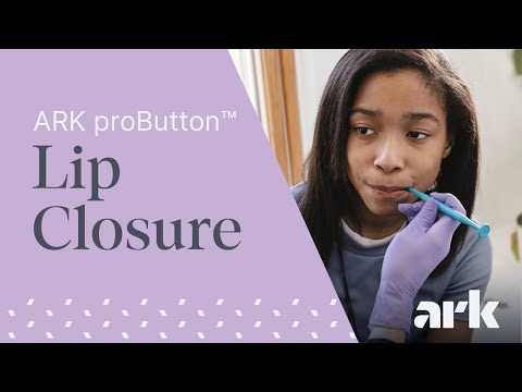 proButton™ Button Pull for Lip Strength & Closure