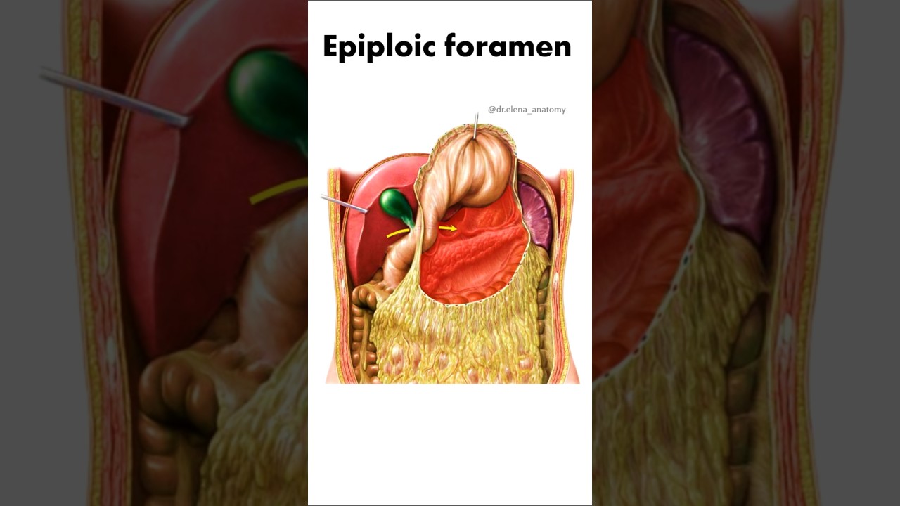 Epiploic foramen | Boundaries | Peritoneum Anatomy