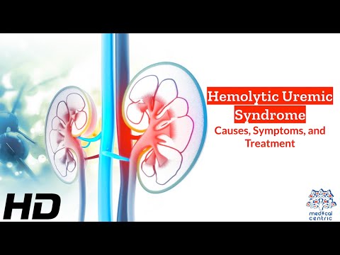 Hemolytic Uremic Syndrome: A Silent Threat Unveiled