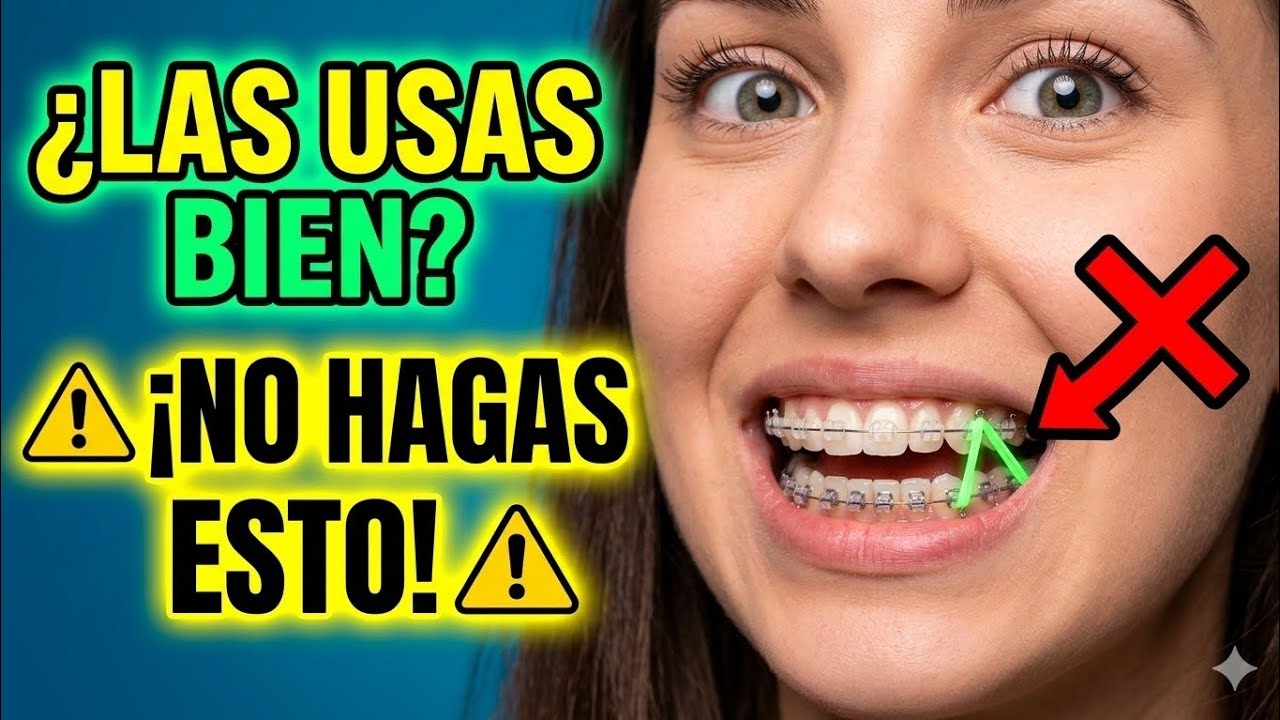 ​¿Para qué sirven las ligas en los brackets? 🦷 Guía completa de uso