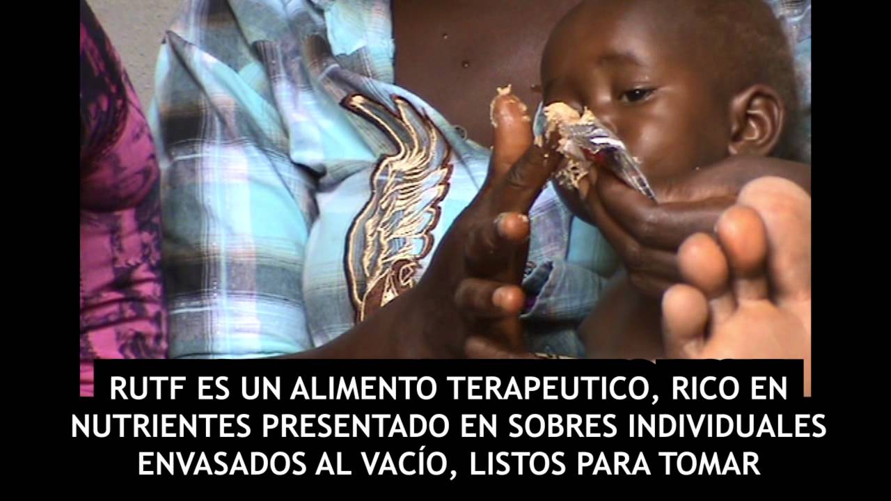 El tratamiento de la desnutrición en Acción contra el Hambre