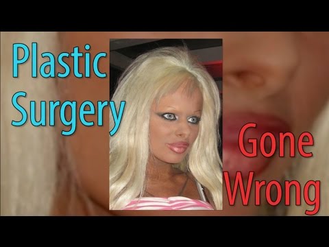 Plastic Surgery Gone Wrong - PSC Uncut - Ep.10