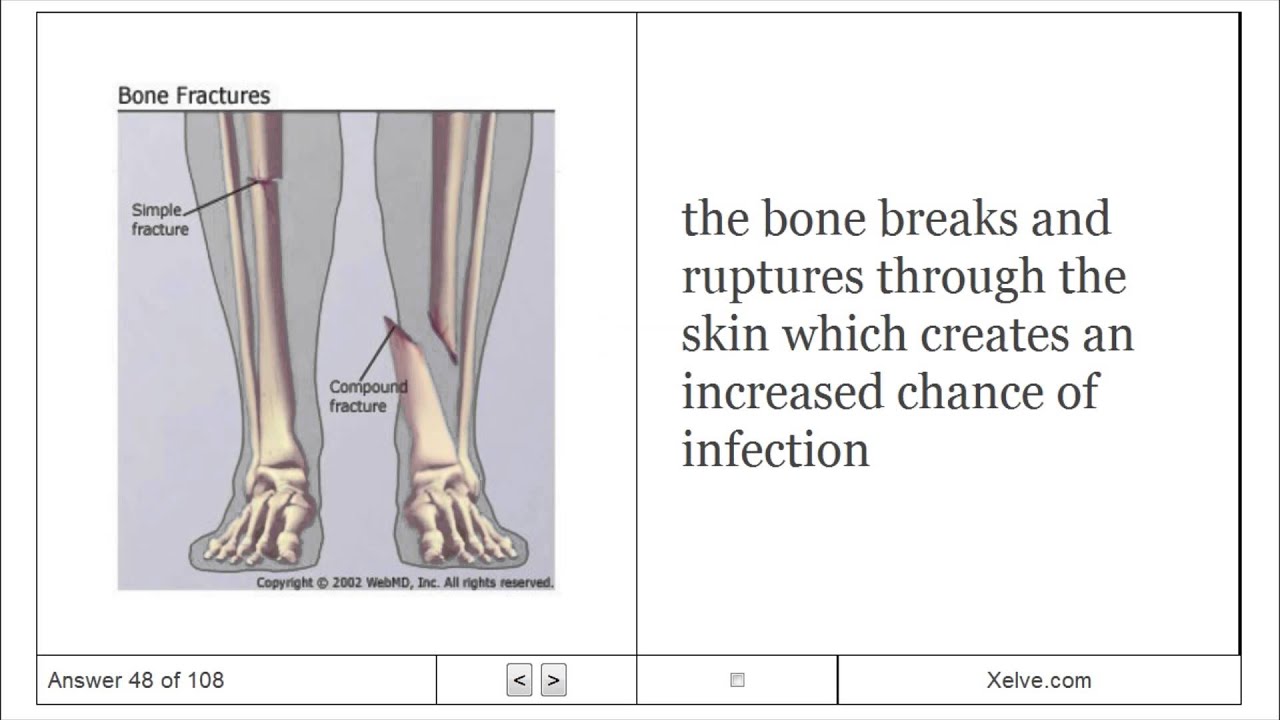 Introduction to Human Anatomy and Physiology - 5 The Skeletal System - Flashcards