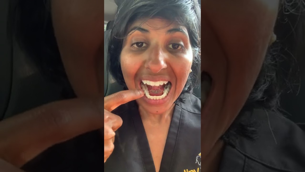 Laser Tongue Tie Release (frenectomy)