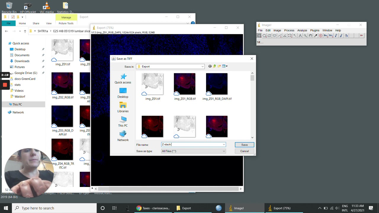 ImageJ: Z-Stack and Projection