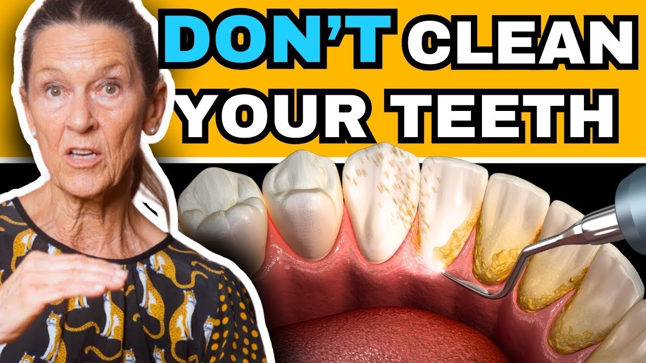 Do You really Need a Teeth Cleaning?