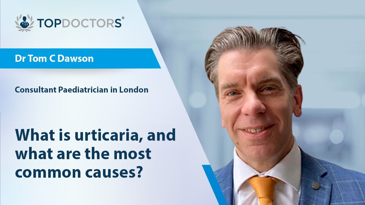 What is urticaria, and what are the most common causes? - Online interview